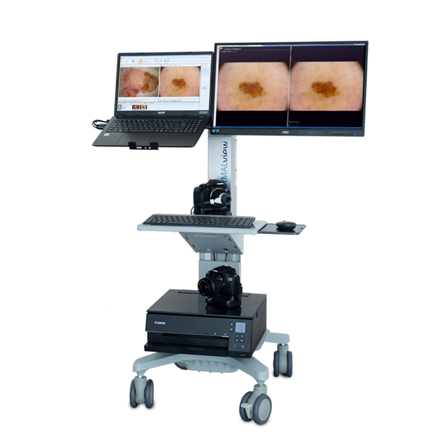 Videodermatoscopio DERMALview Laptop