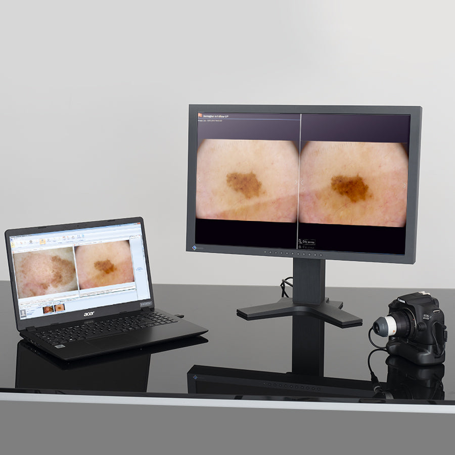 Videodermatoscopio DERMALview Portable